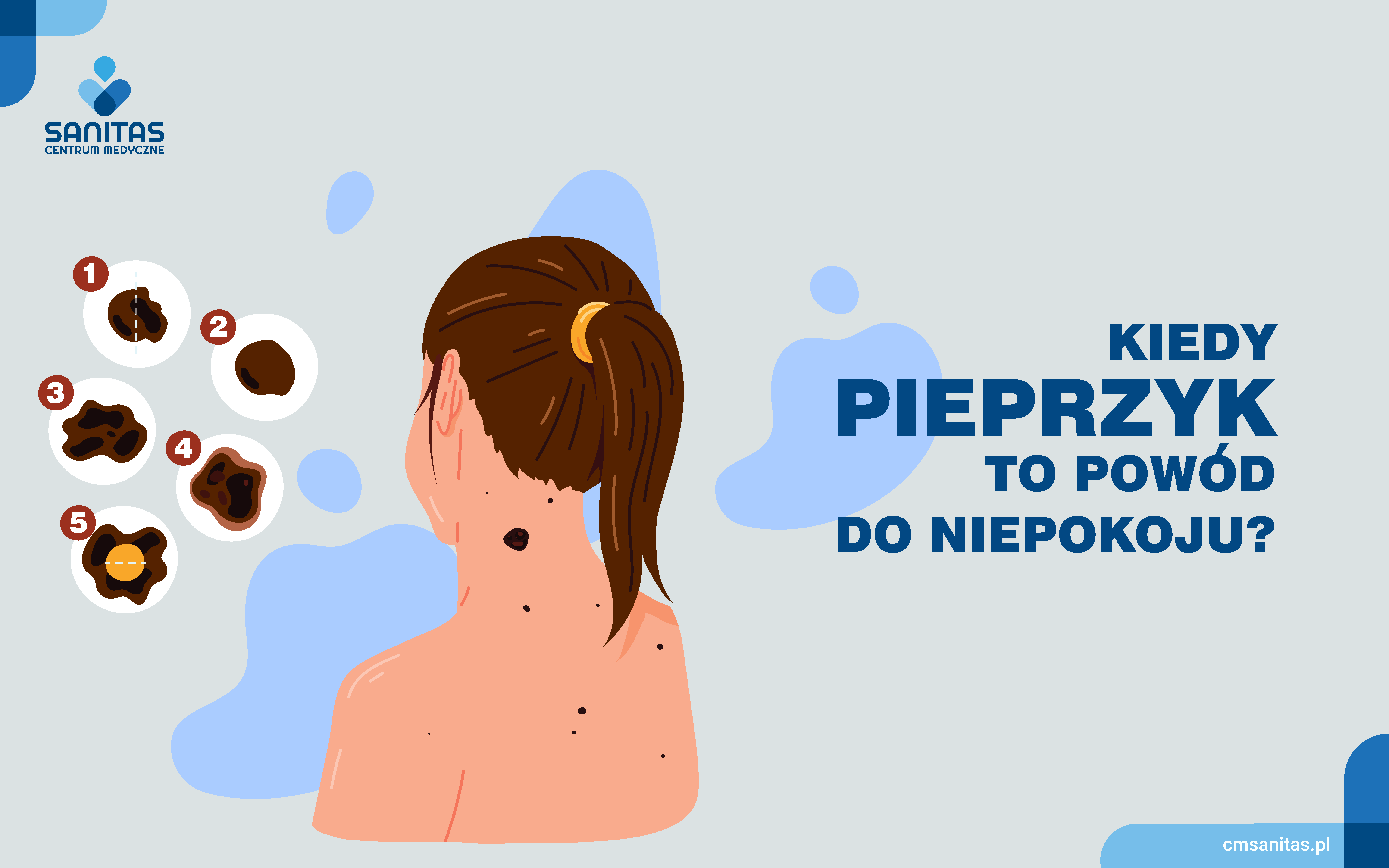 Pieprzyk, brodawka, włókniak – czy wiesz, co oznacza Twoja zmiana na ...
